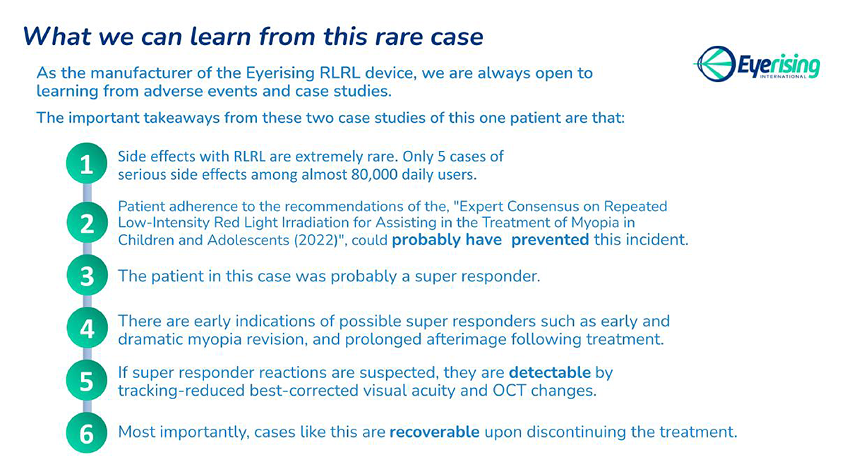 RLRL Treatment for Myopia: Safety and Side Effects | Conexiant